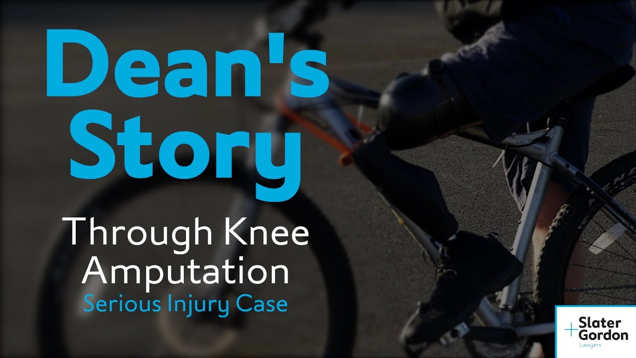 Through-knee Amputation: Dean's Story - YouTube