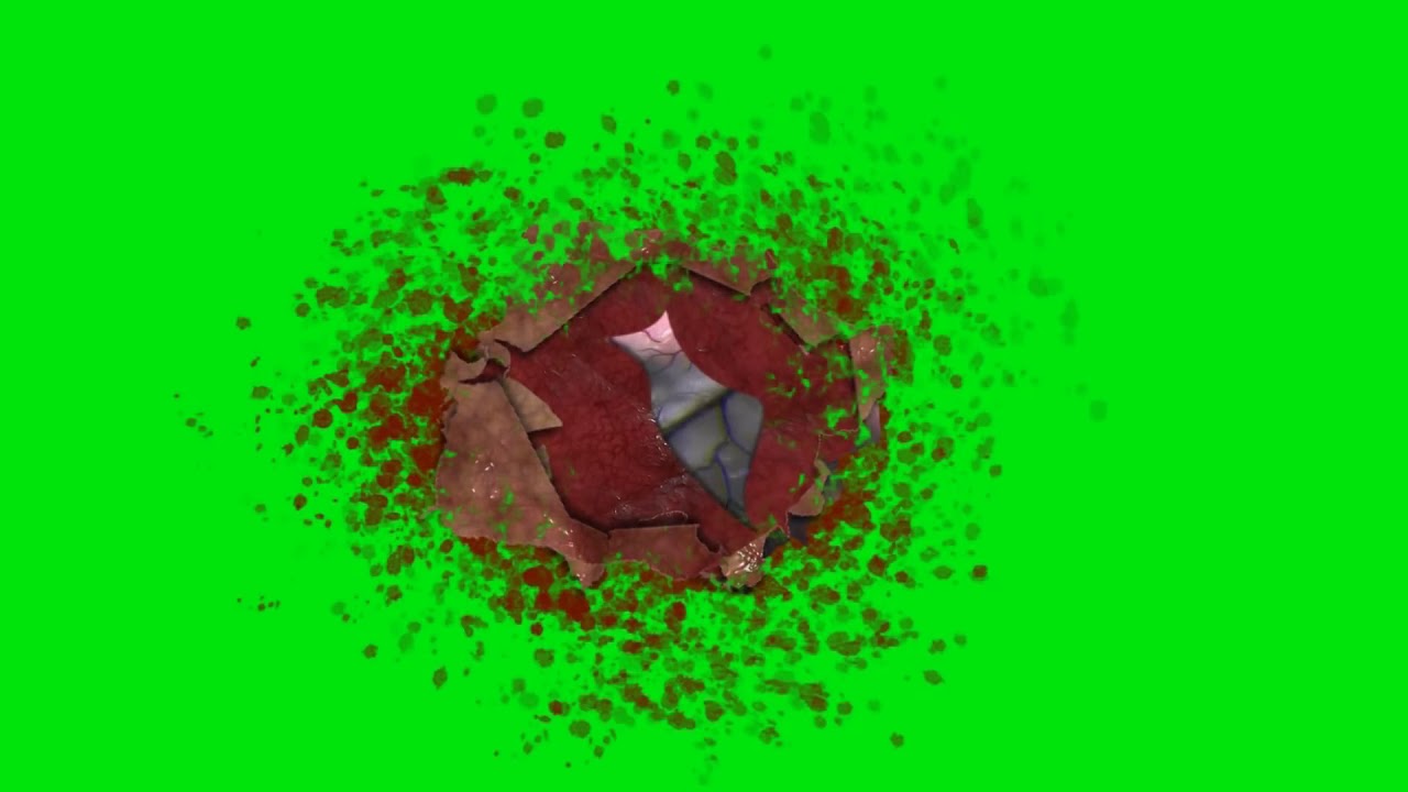 Severe Gun Wound - Green Screen Animation - YouTube