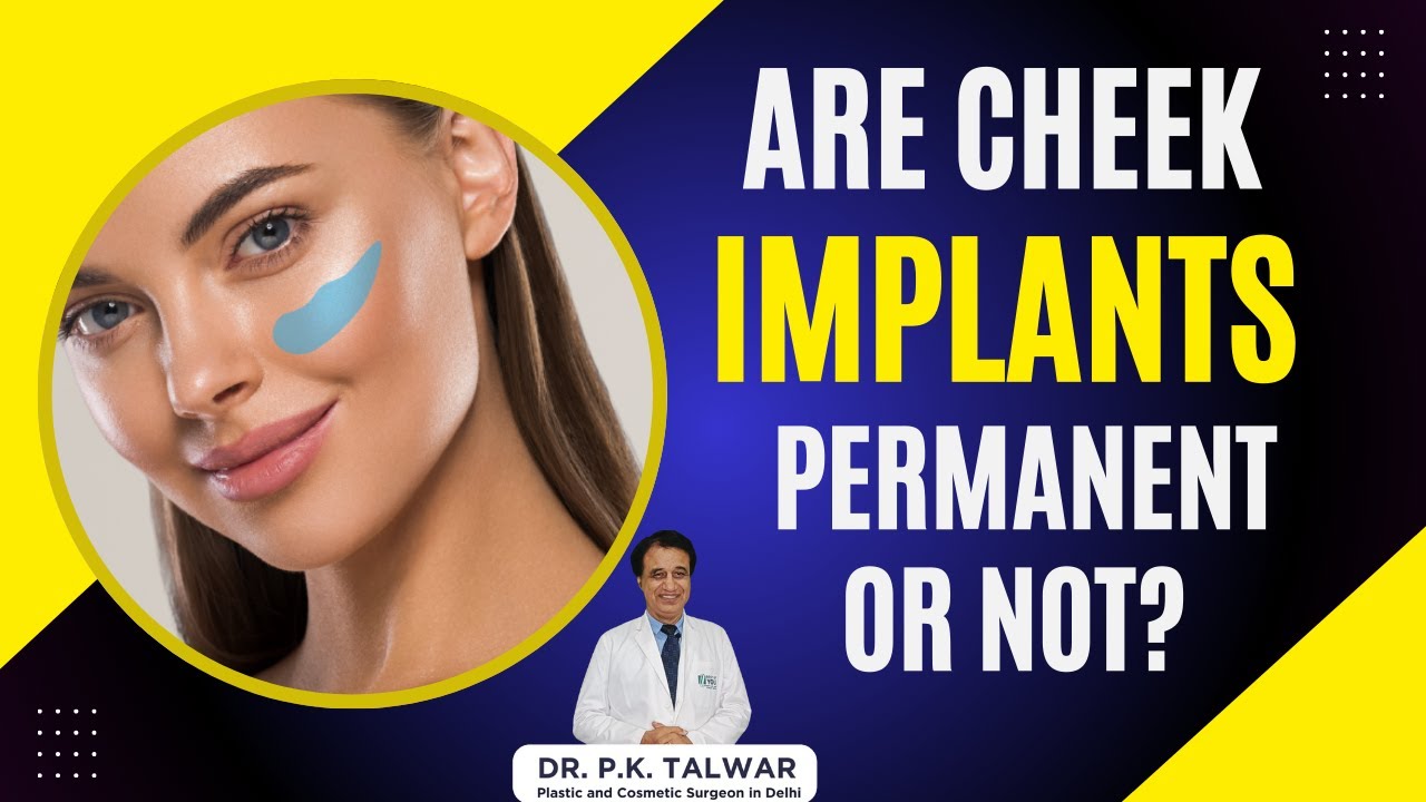 Are Cheek Implants Permanent or not? Cheek Implant Surgery In Delhi ...