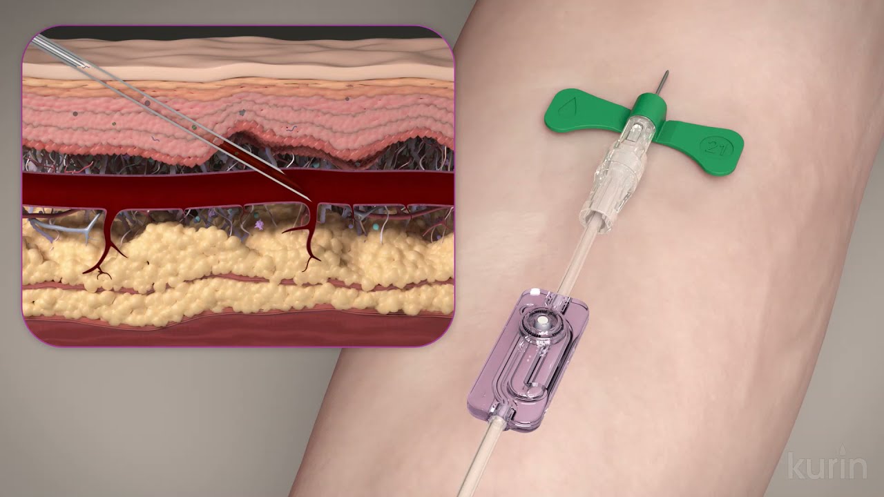 Kurin Blood Culture Collection Set with Flash Technology - YouTube