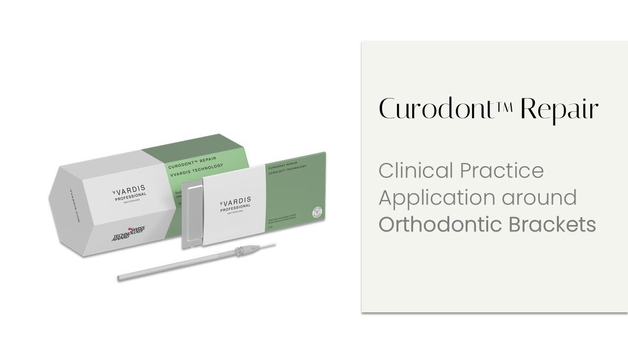 Curodont Repair Application around Orthodontic Brackets - YouTube