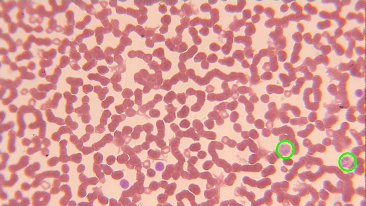 Blood Smear Slide - YouTube