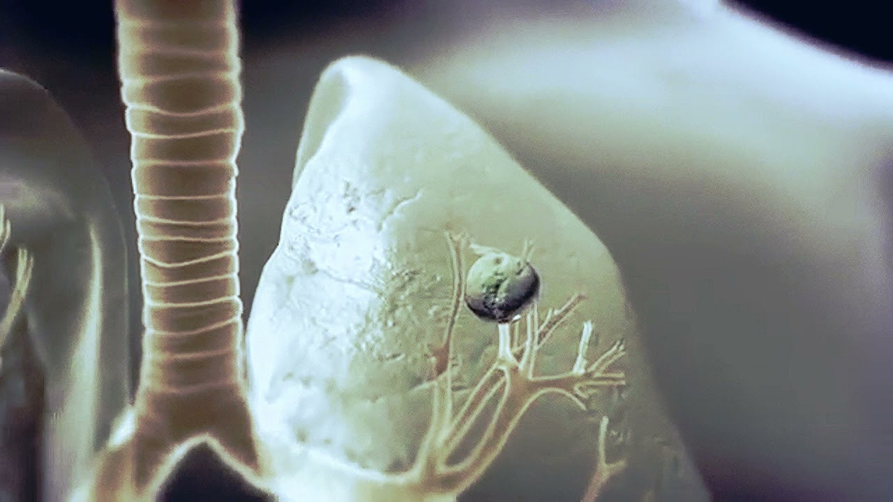 Tuberculosis (TB): Transmission and Pathogenesis - YouTube