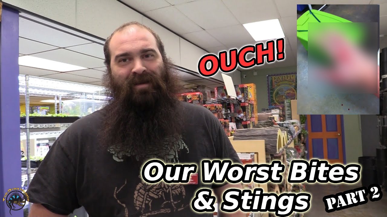 The TDI Team's Worst Bites and Stings - Part 2! 😱 - YouTube