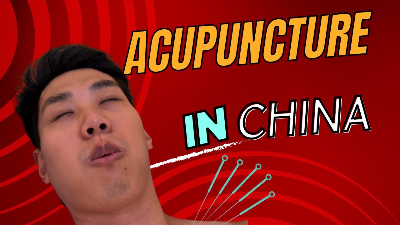 The Surprising World of Acupuncture in Yiwu China - YouTube