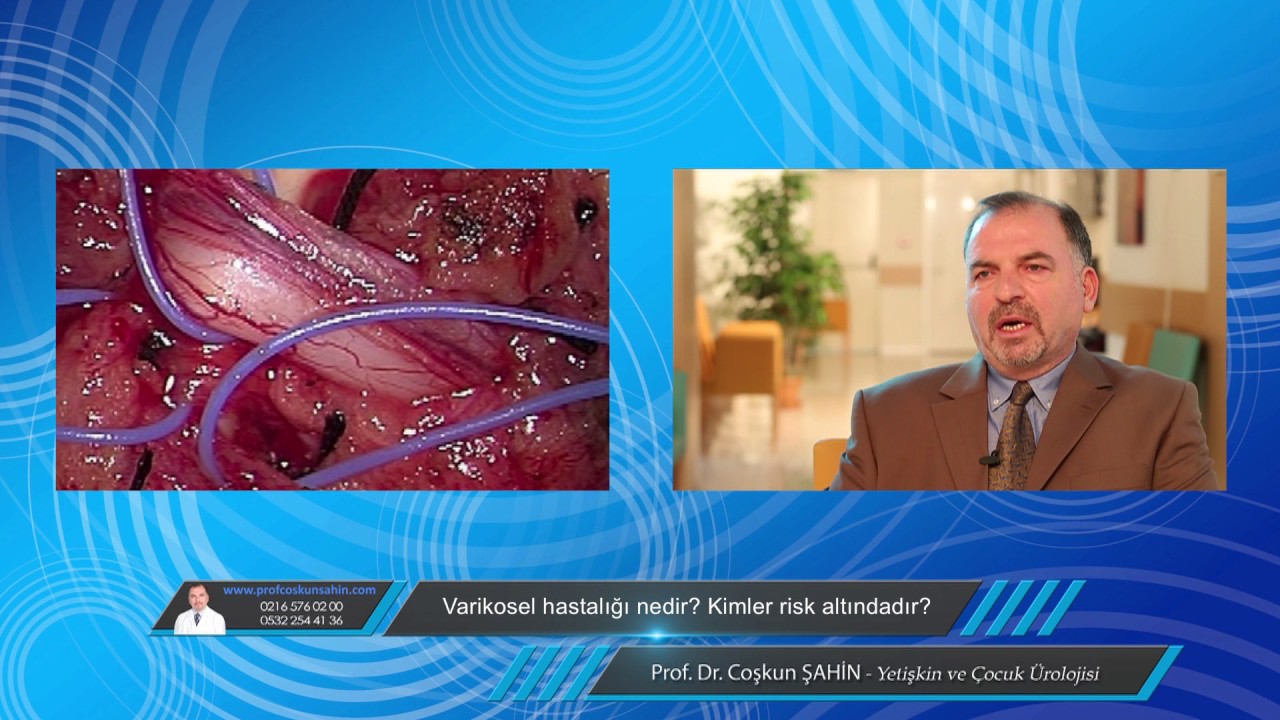 Varikosel hastalığı nedir? Varikosel hastalığında kimler risk ...