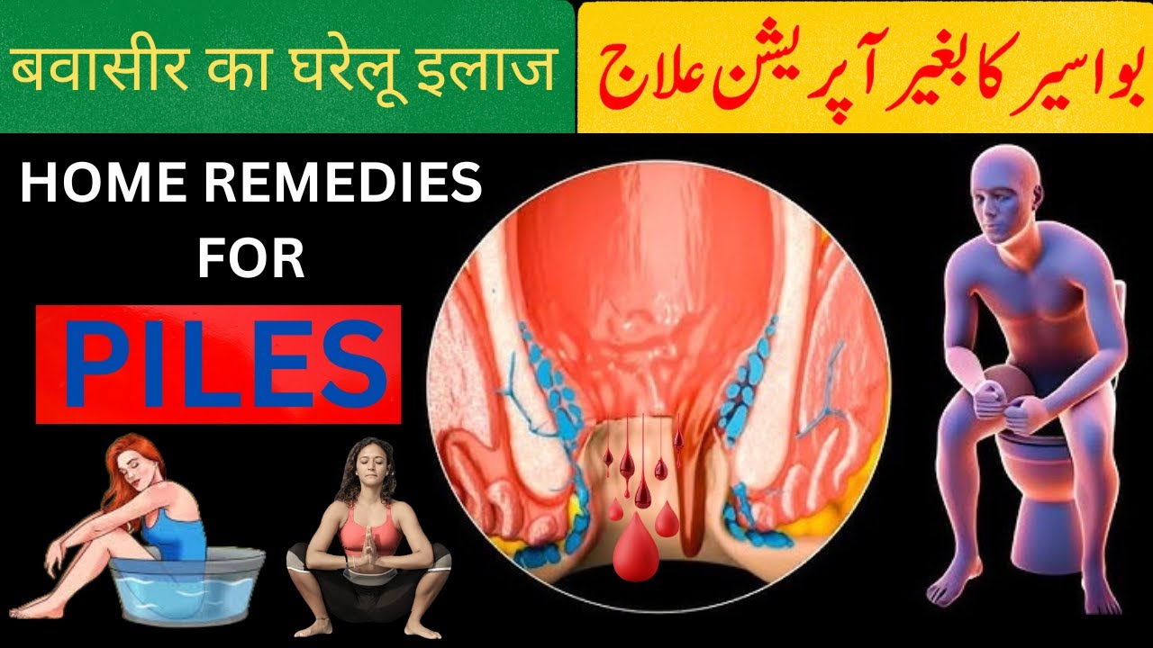 Piles Treatment at Home | Bavasir ka ilaj #piles #haemorrhoids #bavseer ...