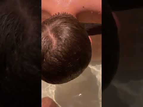 Cold bath challenge ￼￼