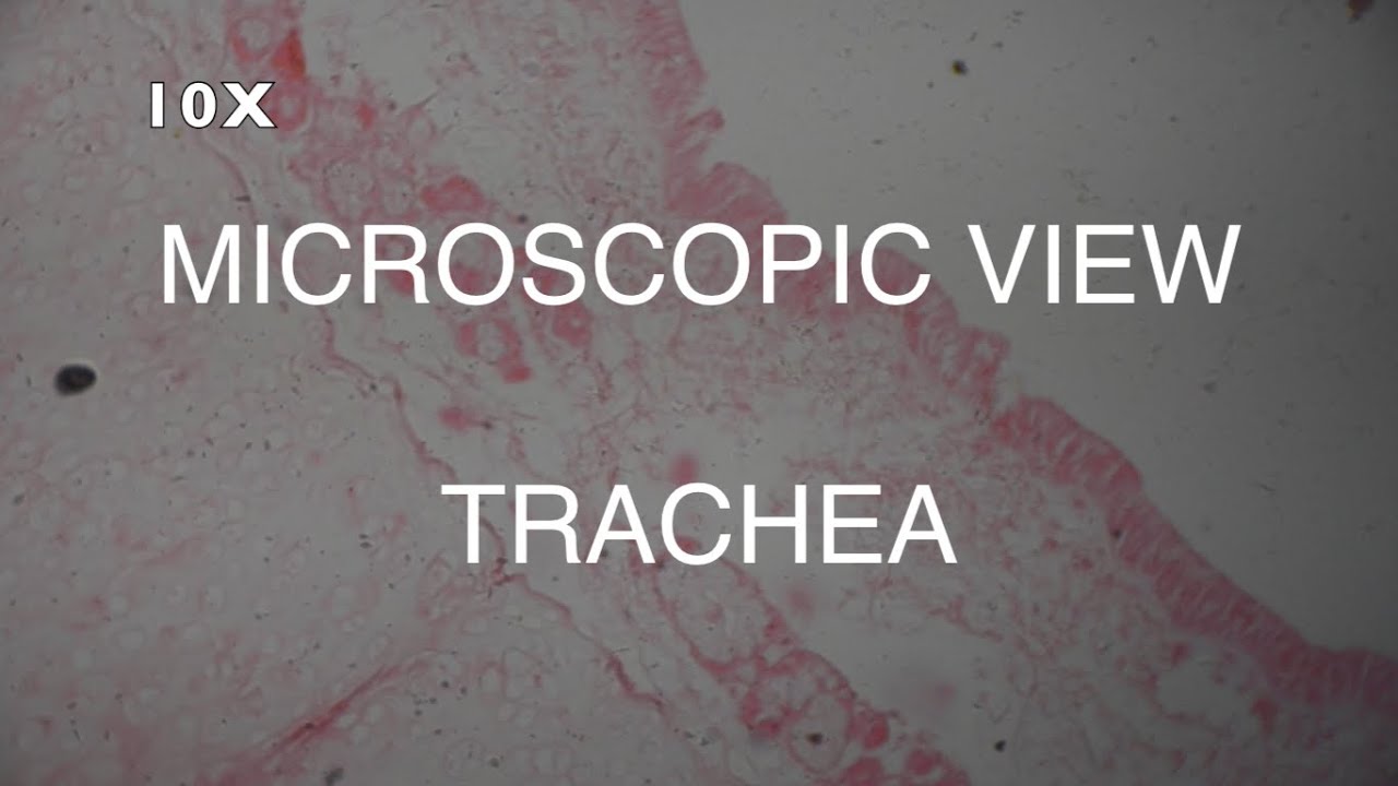 MICROSCOPIC VIEW - TRACHEA - YouTube