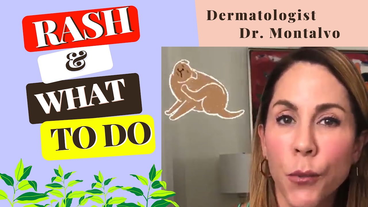 Rash and What To Do About It!! A Dermatologist's recommendation. How to ...