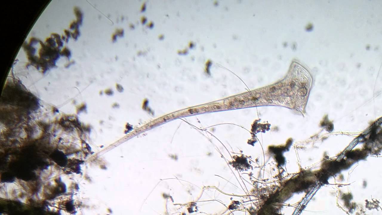 Stentor - Wide View - 100x - YouTube