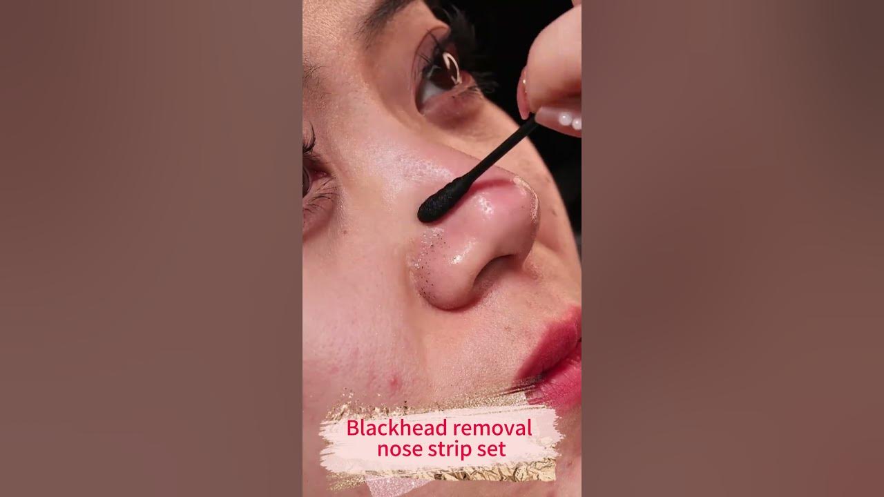 Black Dots on the Nose? Sebaceous Filaments & How to get rid of them #blackheadsremoval # ...
