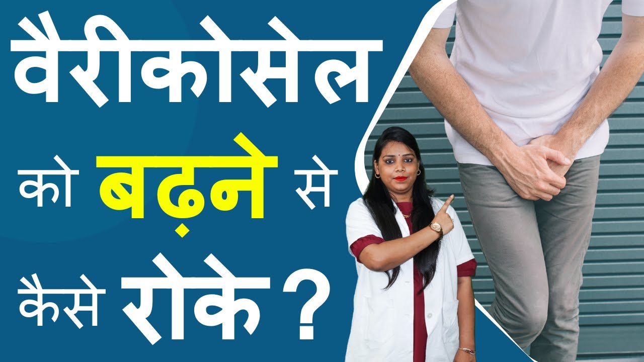 Lifestyle Changes in Varicocele | Varicocele Ko Badhne Se Kaise Roke ...