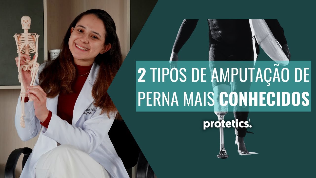 Os 2 TIPOS mais COMUNS de AMPUTAÇÃO de PERNA - YouTube