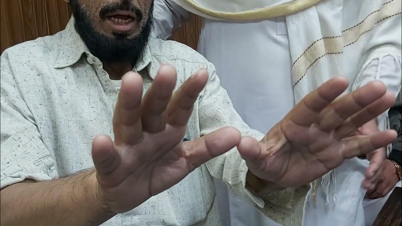 Flapping Tremor Diagnosed As CLD YouTube flapping-tremor-diagnosed-as-cld-youtube