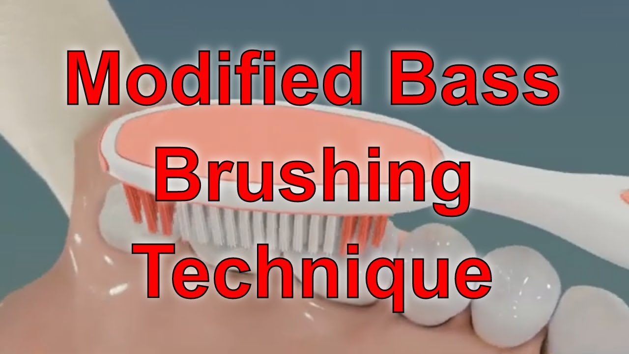 Tooth brushing, Oral Hygiene, Modifies Bass Method brushing technique ...