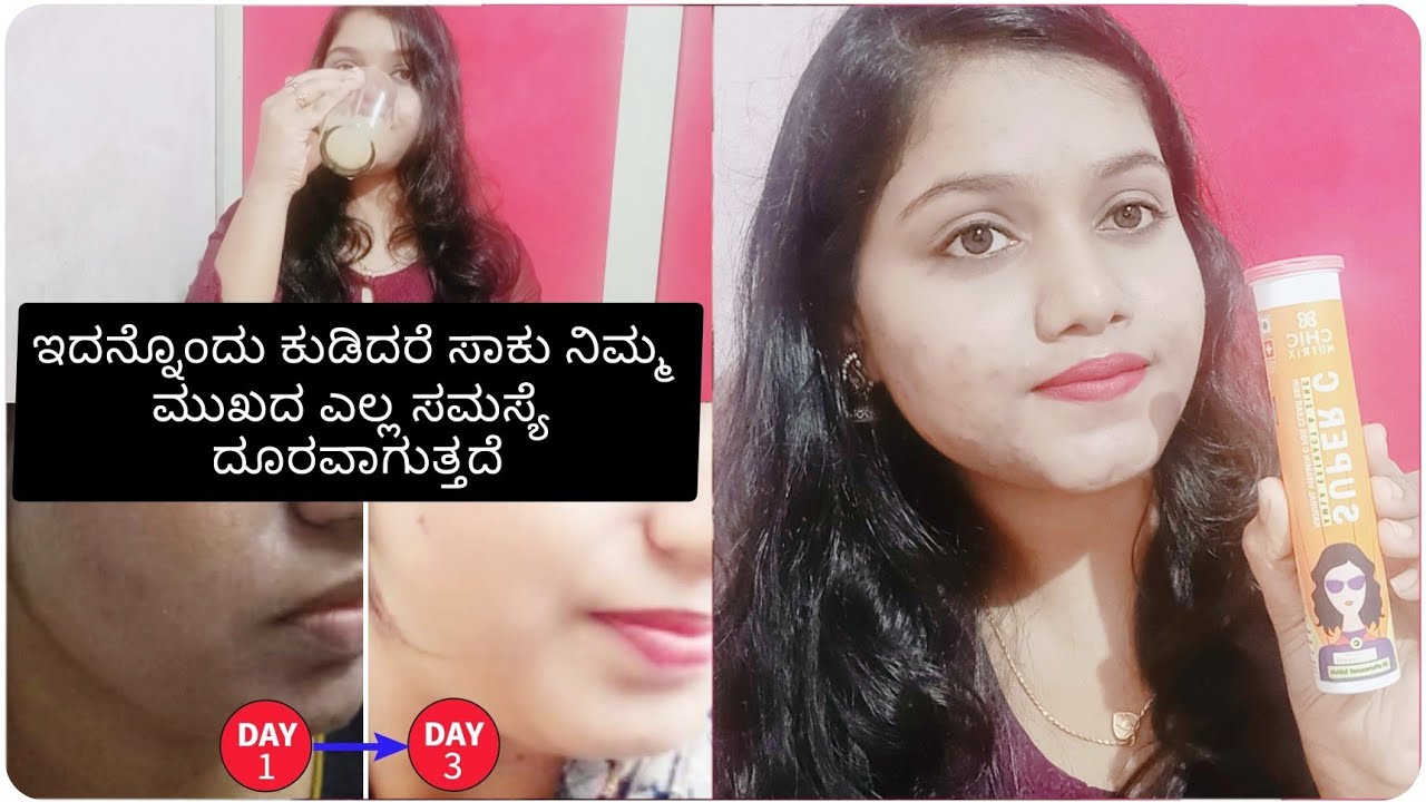 Vitamin C Supplement For Glowing Skin||Chic Nutrix Super C||Acne Free ...