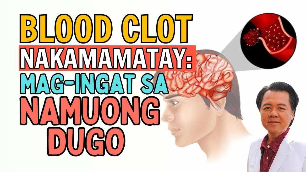 Blood Clot Nakamamatay: Mag-ingat sa Namuong Dugo - YouTube