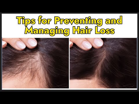How to prevent hair loss II Managing hair loss naturally II Effective ...