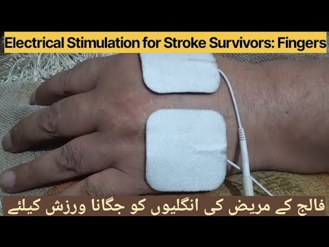 Stroke Rehabilitation: Use of electrical stimulation to help the ...