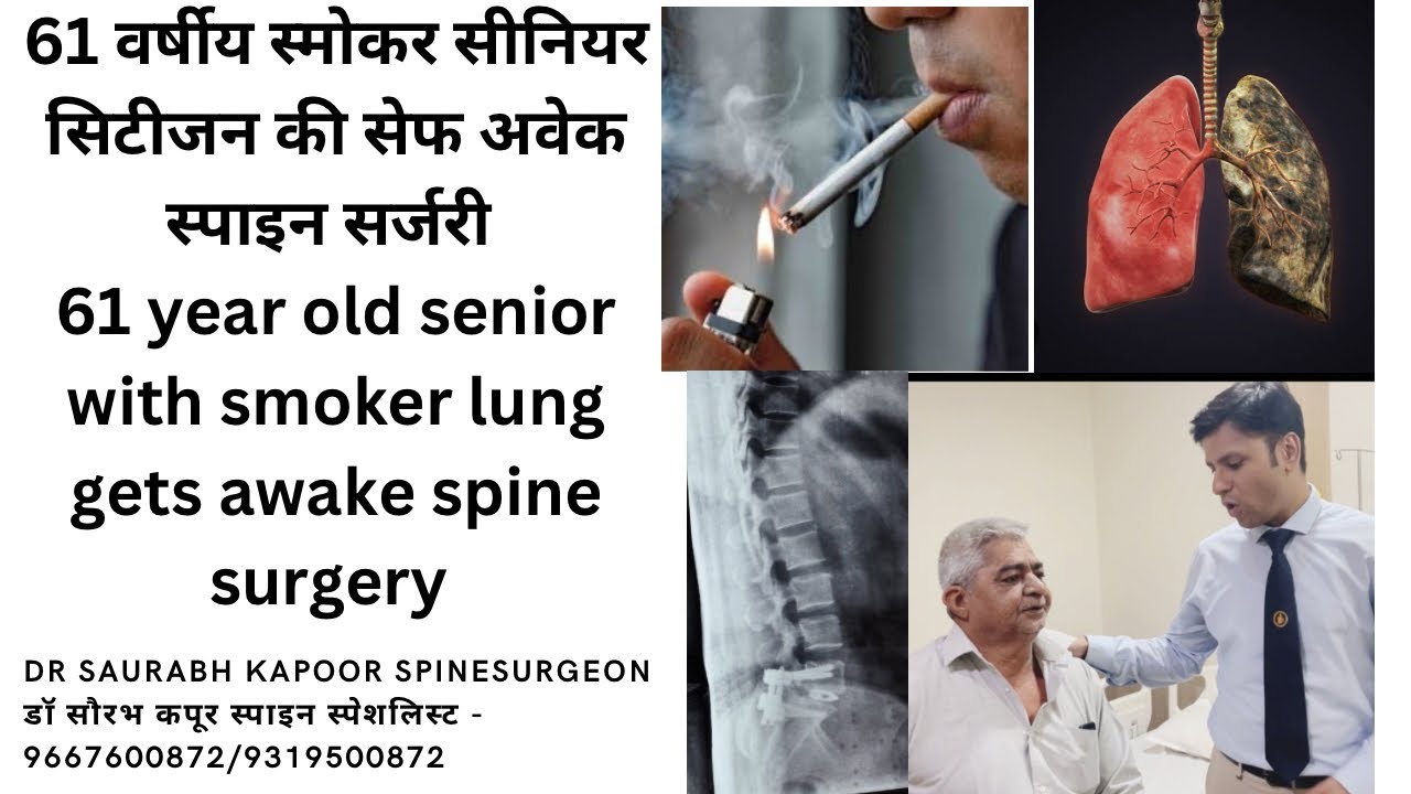 61 year old senior citizen with smoker lung gets safe awake endoscopic ...