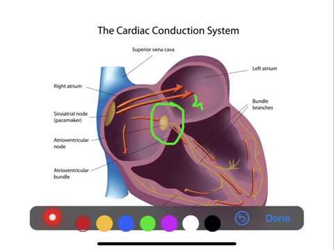 ECG Basics 10 Junctional Escape Rhythm - YouTube