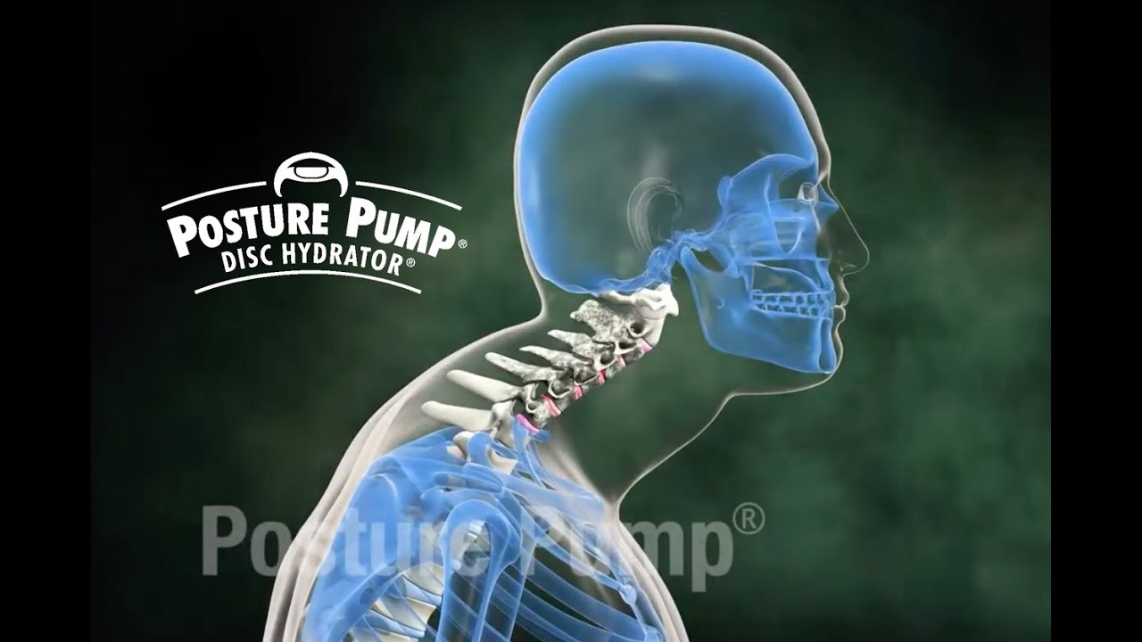 Posture Pump® Neck & Back Disc Hydrators® - YouTube