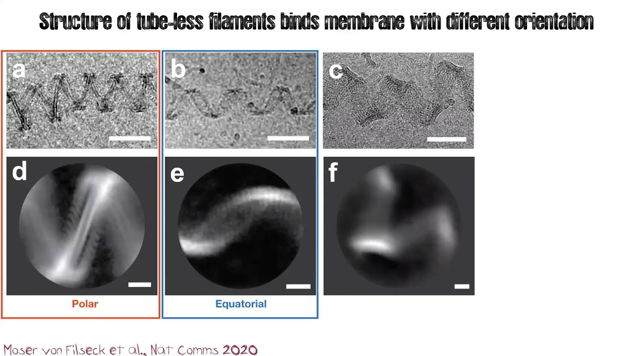 The unique ESCRT-III mechanics that drives membrane remodelling - Oct ...