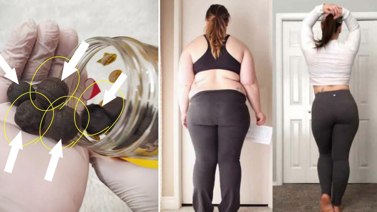 How I Lost Weight From 164 Kg To 63 Kg In A Month Using This Drink how-i-lost-weight-from-164-kg-to-63-kg-in-a-month-using-this-drink