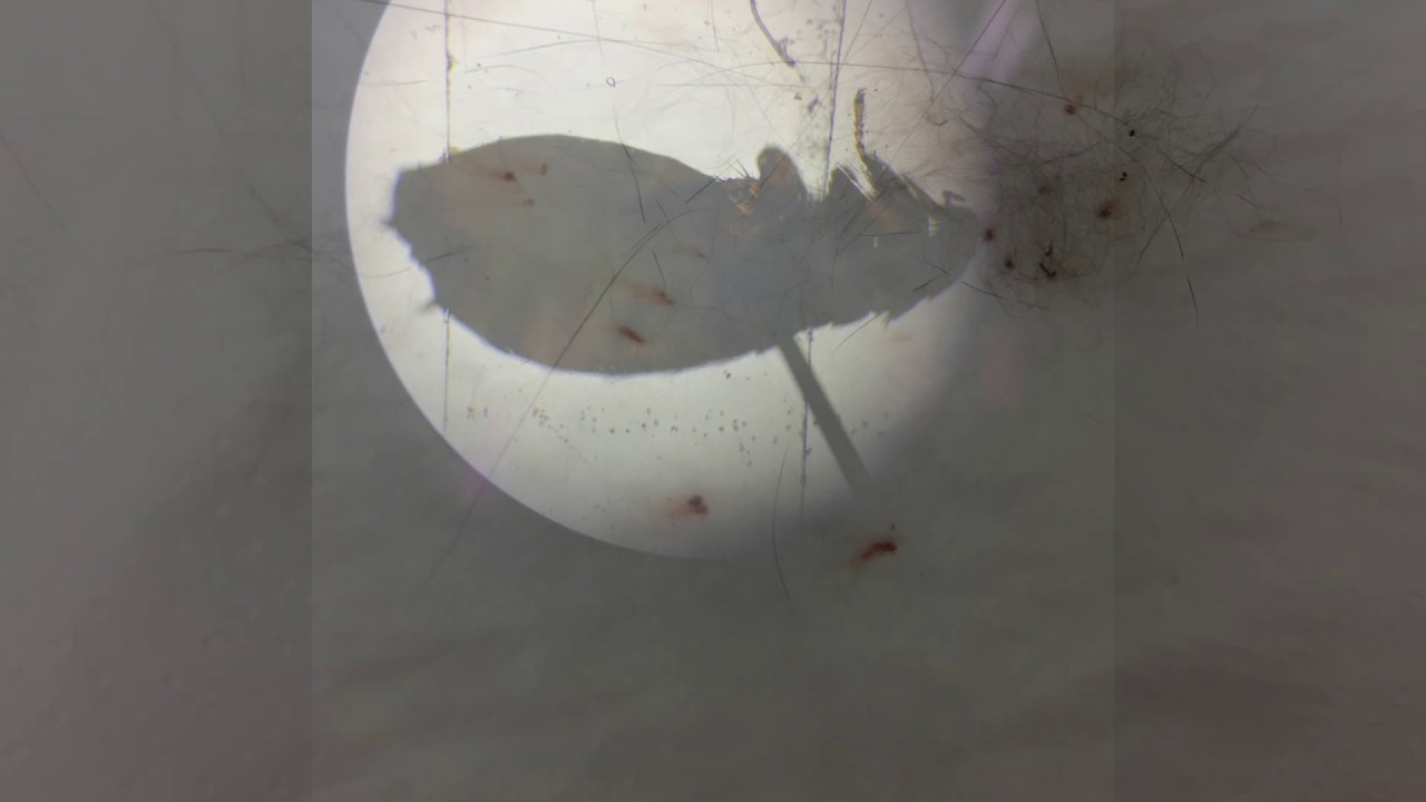 Flea under microscope and flea dirt once its been dampened - YouTube