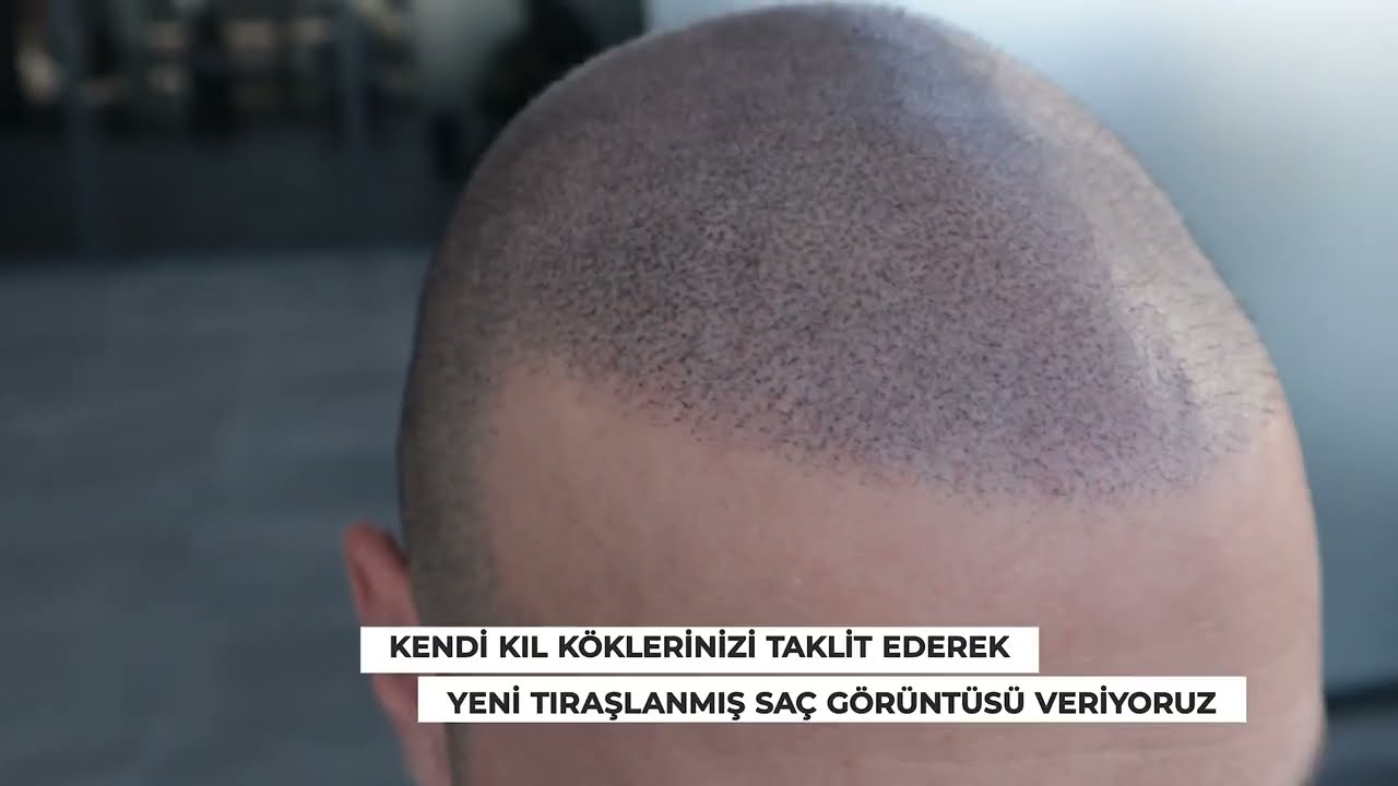 KIL KÖKÜ GÖRÜNÜMÜ TEKNİĞİ NEDİR? - YouTube
