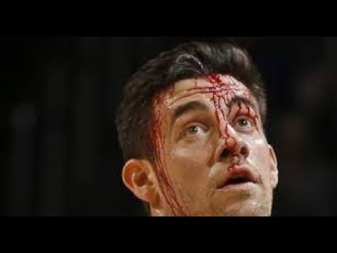 Depantsed! OKC Thunder big man Nick Collison on the time he got his shorts pulled down during game.