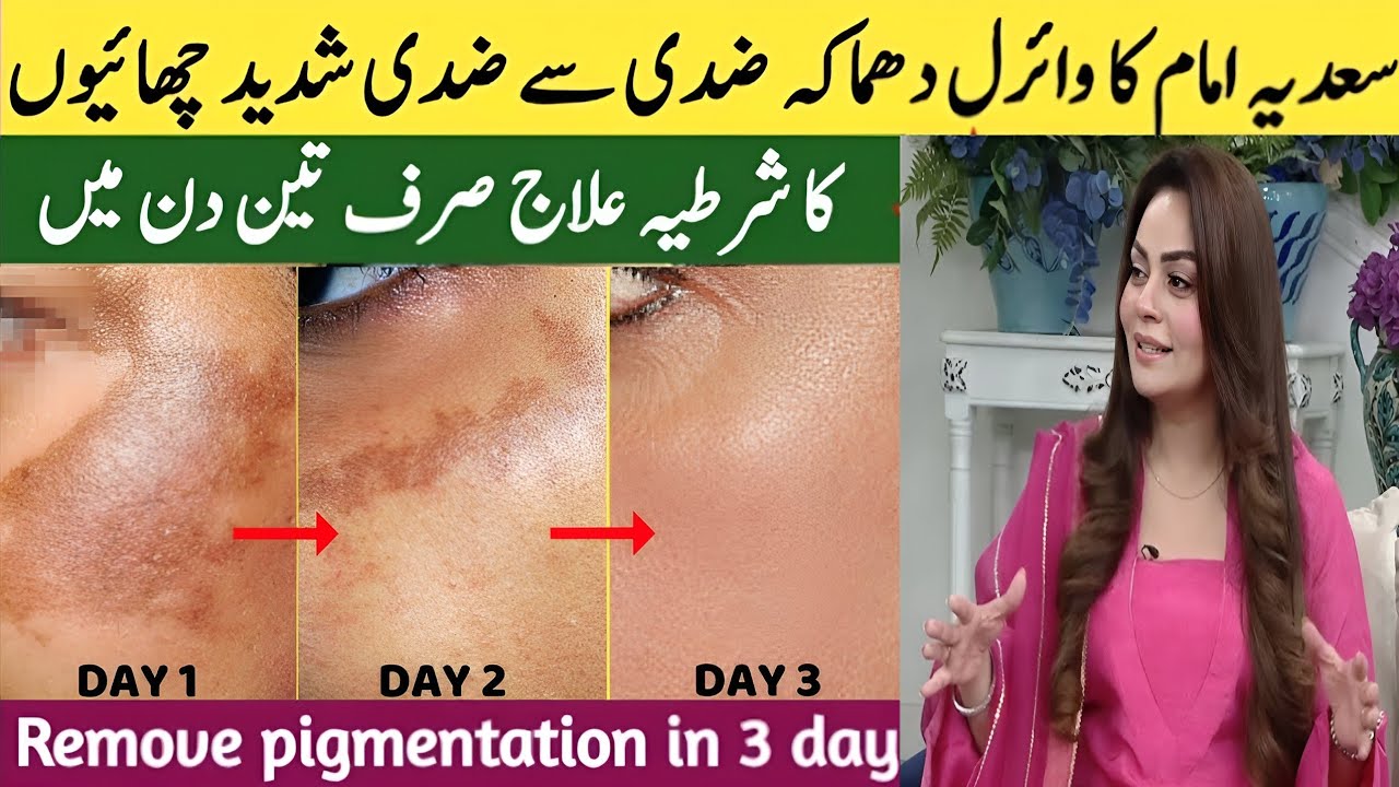 Disprin Tablet For Skin Pigmentation and Anti Aging | Get Beautiful ...