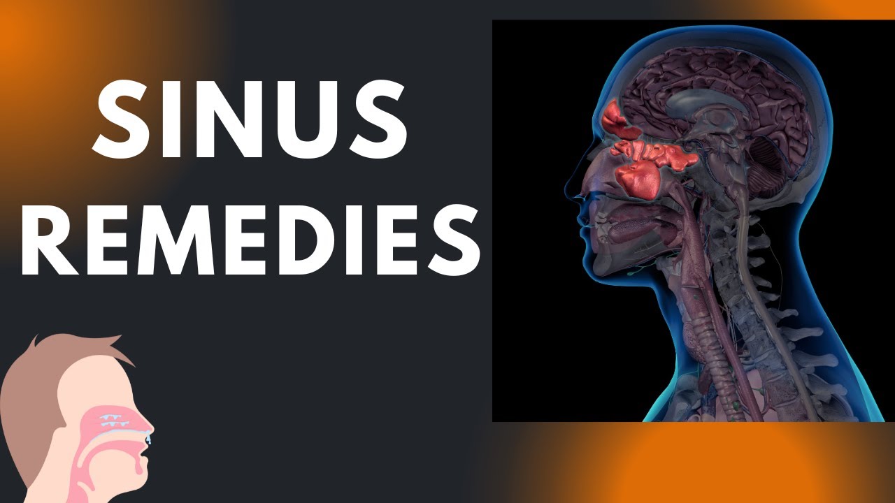 Fast Relief for Sinusitis: Home Remedies You Need for Quick, Natural ...