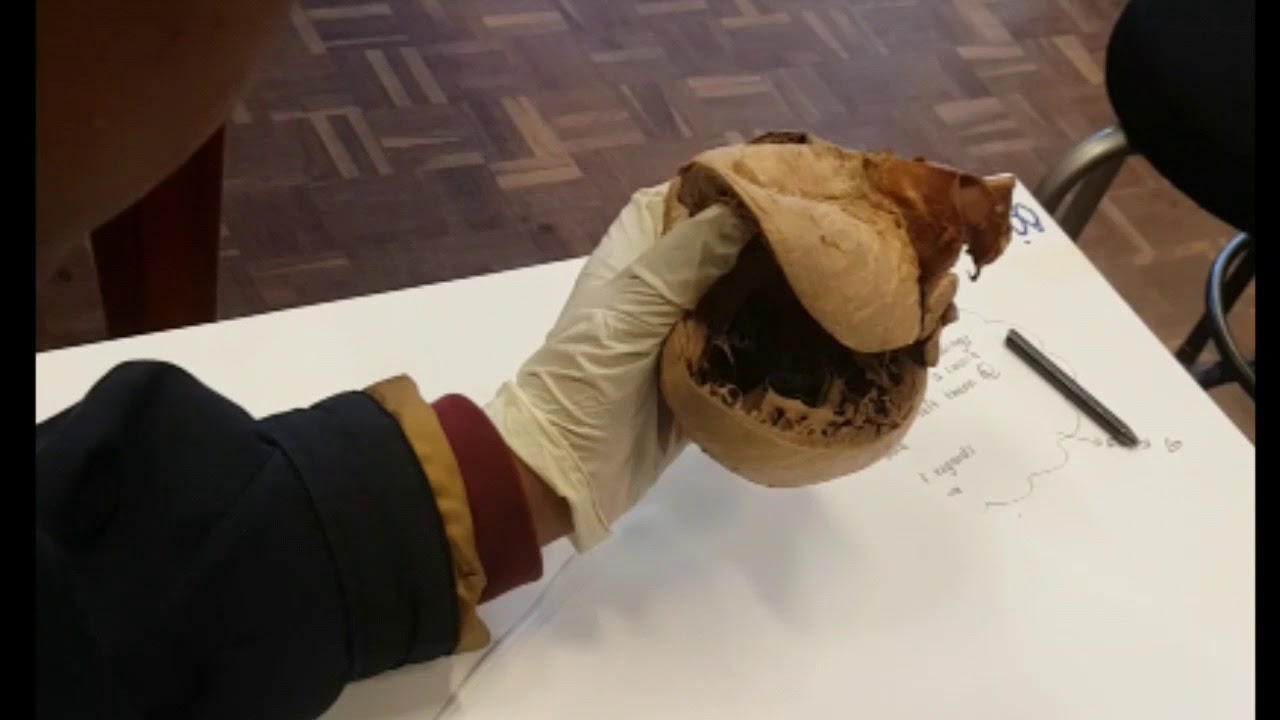 Anatomy observation & drawing. Wet specimen. Heart. - YouTube