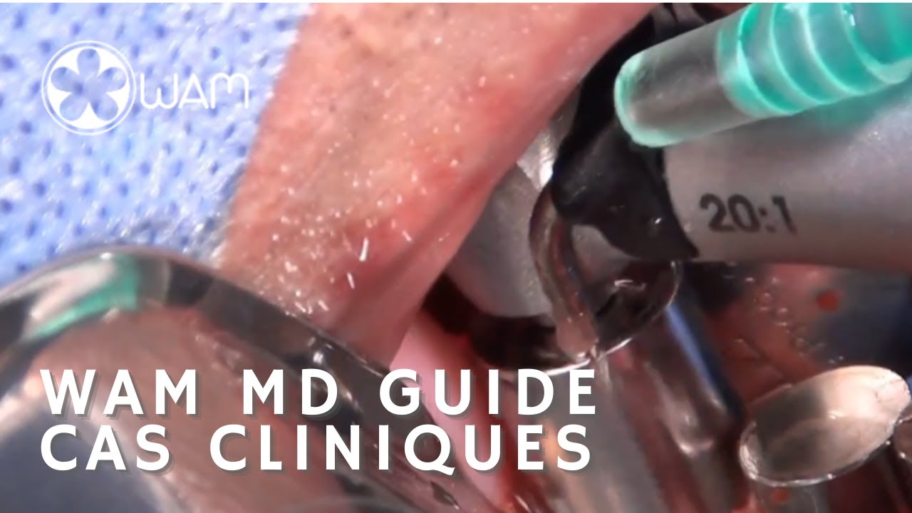 WAM MD Guide - Cas cliniques Dr Stéphane PLAN 2013 11 18 v2 TVHD - YouTube