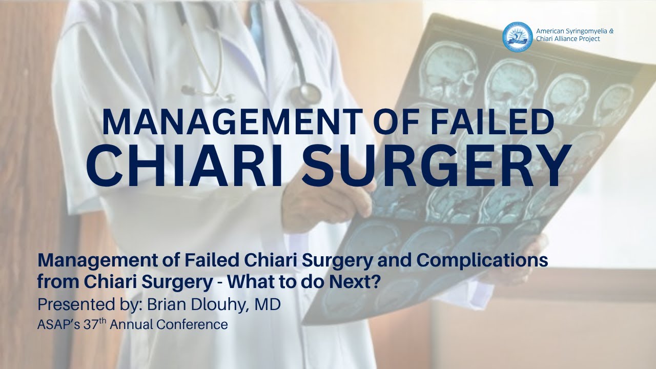 Management of Failed Chiari Surgery & Complications - Brian Dlouhy, MD ...