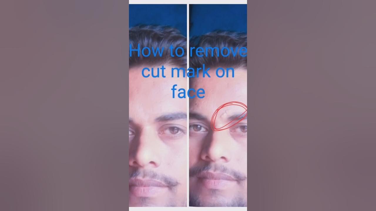 How To Remove Cut Mark On Face shortsvideo youtubeshorts videos how-to-remove-cut-mark-on-face-shortsvideo-youtubeshorts-videos