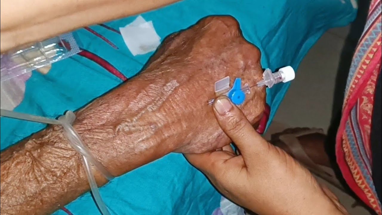 iv Cannulation . Cannula Push Ep 38 injection Vision - YouTube