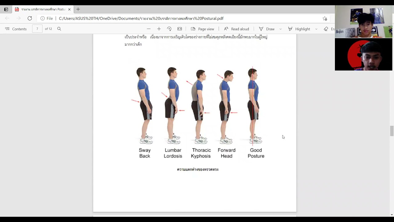 Postural Deviation รูปร่างทรวดทรงผิดปกติ - YouTube