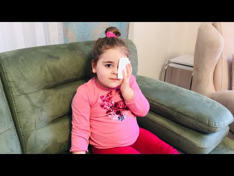 Beren’in Gözü Mikrop Kaptı Doktor Göz Damlası Verdi. Beren Damla yapmak istemedi