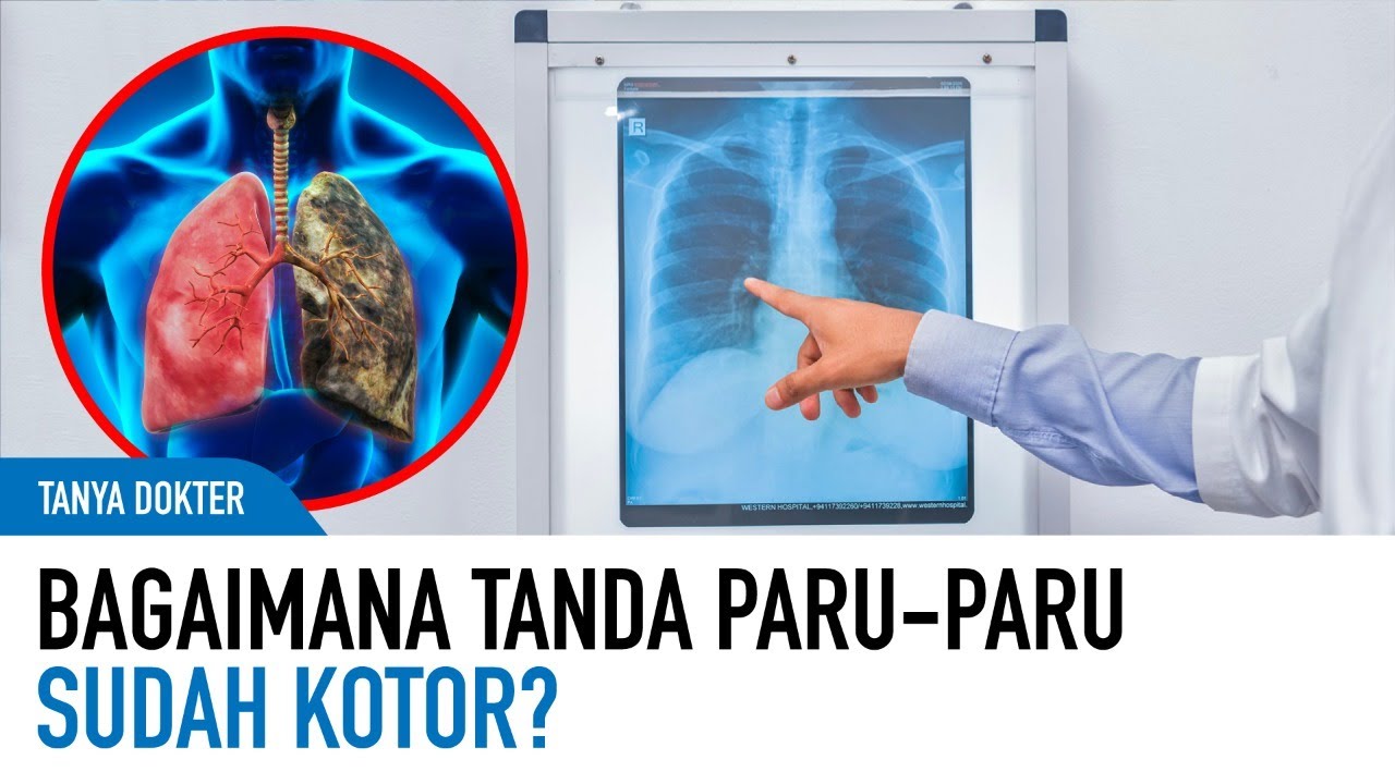 Tanda Paru-Paru Kotor dan Fungsi Penting Paru-Paru Dalam Tubuh Manusia ...