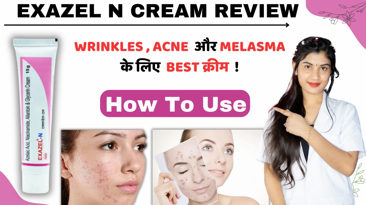 Exazel N Cream how To Use | Azelaic Acid Niacinamide Allantoin and ...