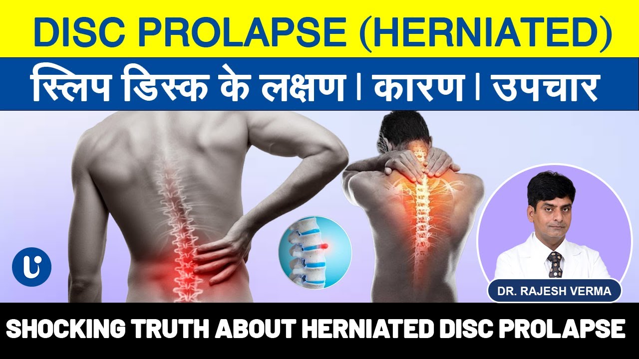 Best Disk Prolapse Treatment in Hindi | डिस्क प्रोलैप्स क्या है और इसका ...