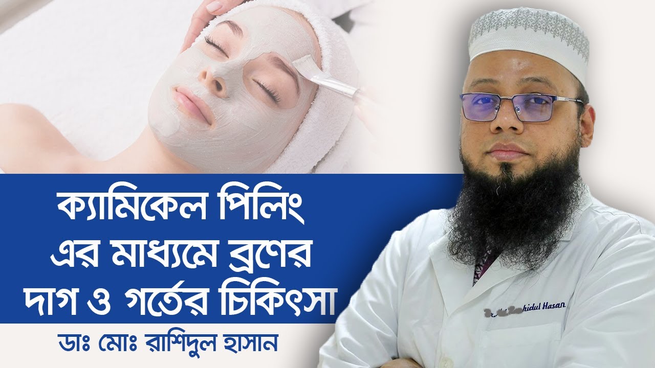 Chemical peels for acne scars - Chemical peeling treatment - Bron er ...