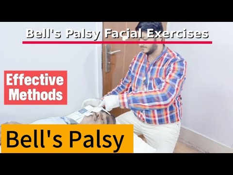 Bell's Palsy Treatment: Effective Facial Exercise Rehabilitation ...