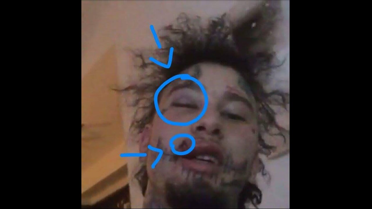 Rapper Stitches Got Jumped By His OWN Friend After The Game Paid Them ...