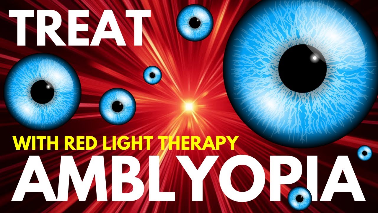 How to Treat Amblyopia with Red Light Therapy - YouTube