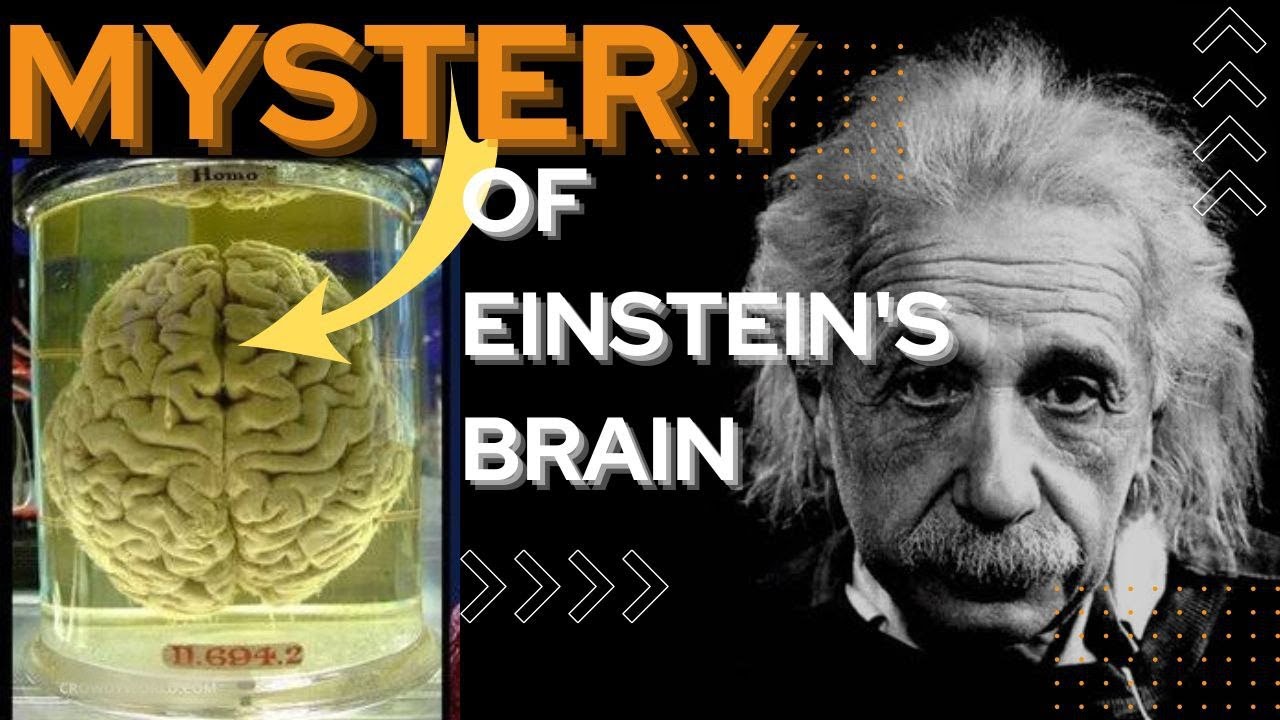 Was Einstein's Brain chopped off?🧠| Einstein | Albert Einstein | Einstein brain | - YouTube