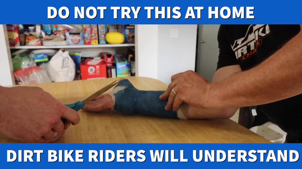 CUTTING OFF CAST TO RIDE DIRT BIKE - YouTube